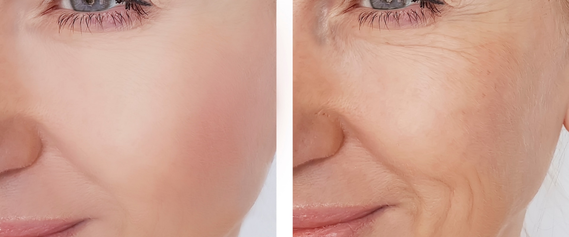 Unlocking the Secrets of Polynucleotides: A Comprehensive Guide to Skin ...