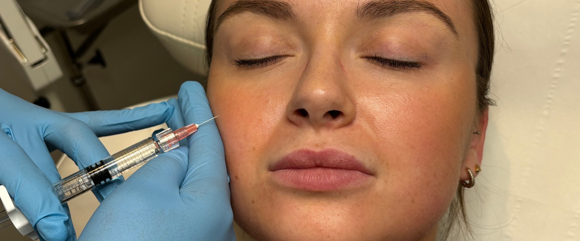 The Power of Combining Polynucleotides and Botox for Comprehensive Skin ...