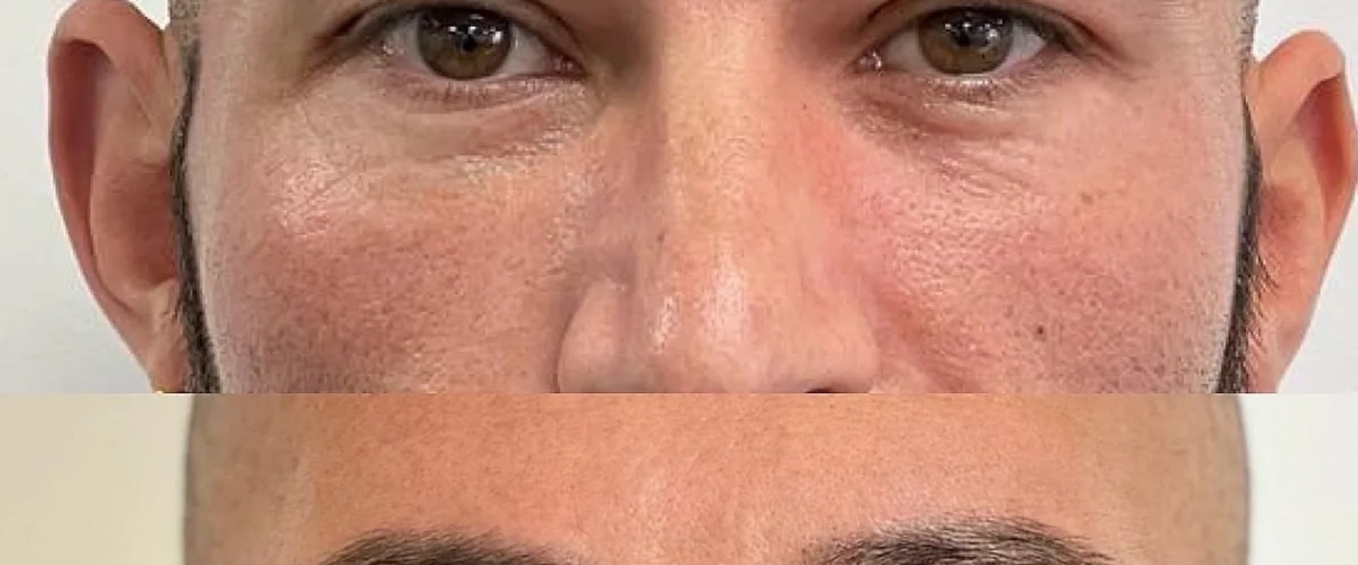 What are the 2 strands of polynucleotide?