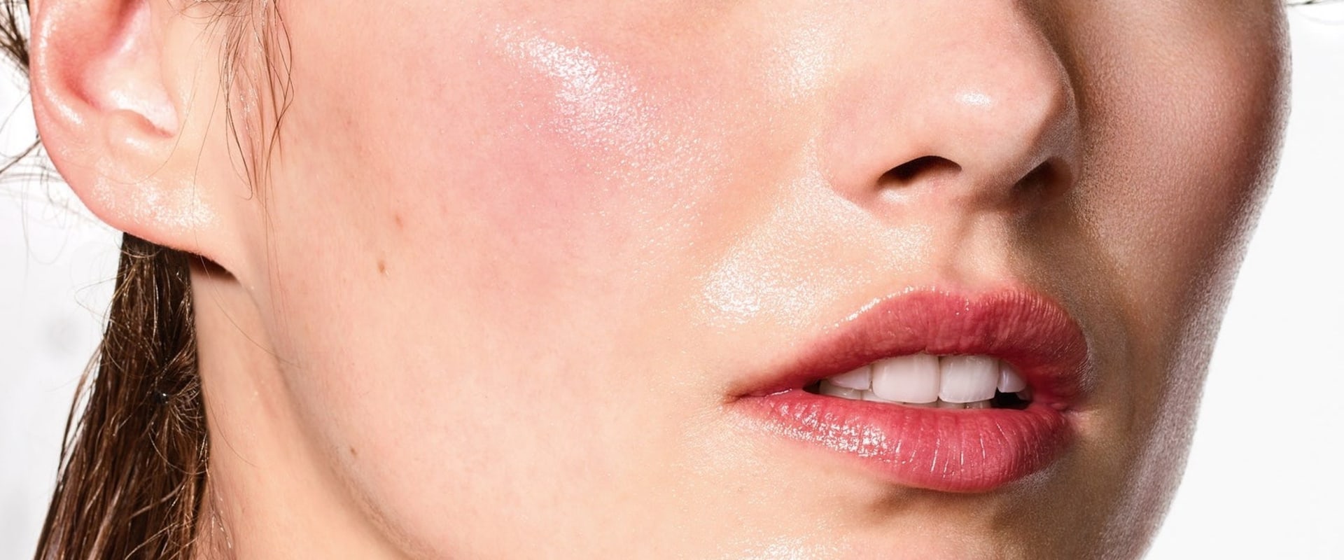 Polynucleotides vs Profhilo: Which is the Better Option for Skin ...